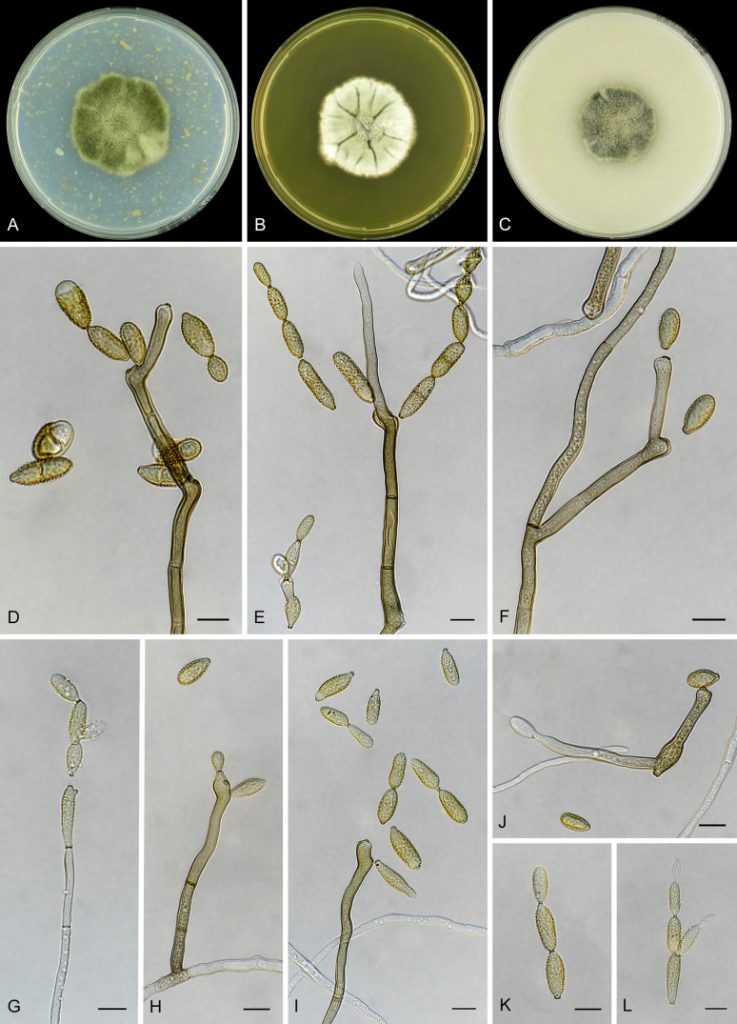 Cladosporium species in indoor environments - Biology Online Archive ...