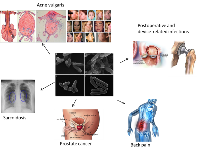 Anaerobic - Definition and Examples - Biology Online Dictionary
