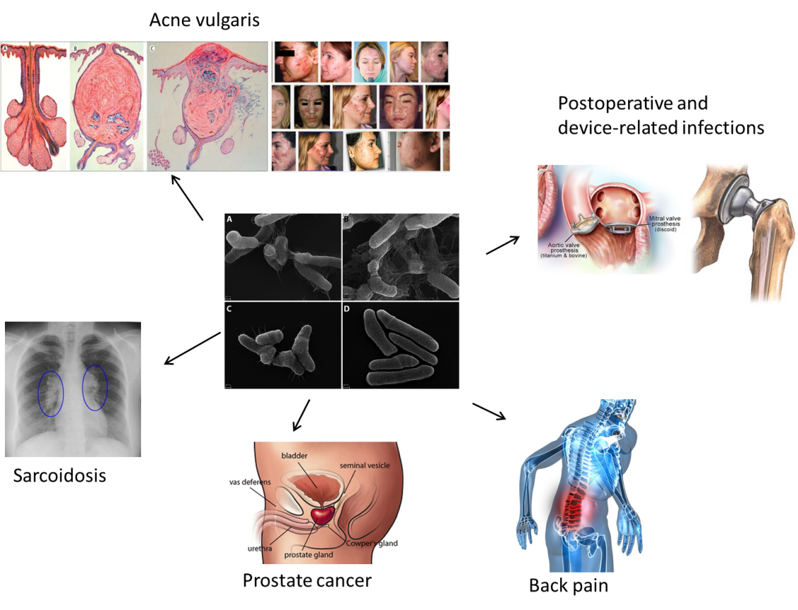 Anaerobic - Definition and Examples - Biology Online Dictionary