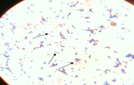 Anaerobic - Definition and Examples - Biology Online Dictionary