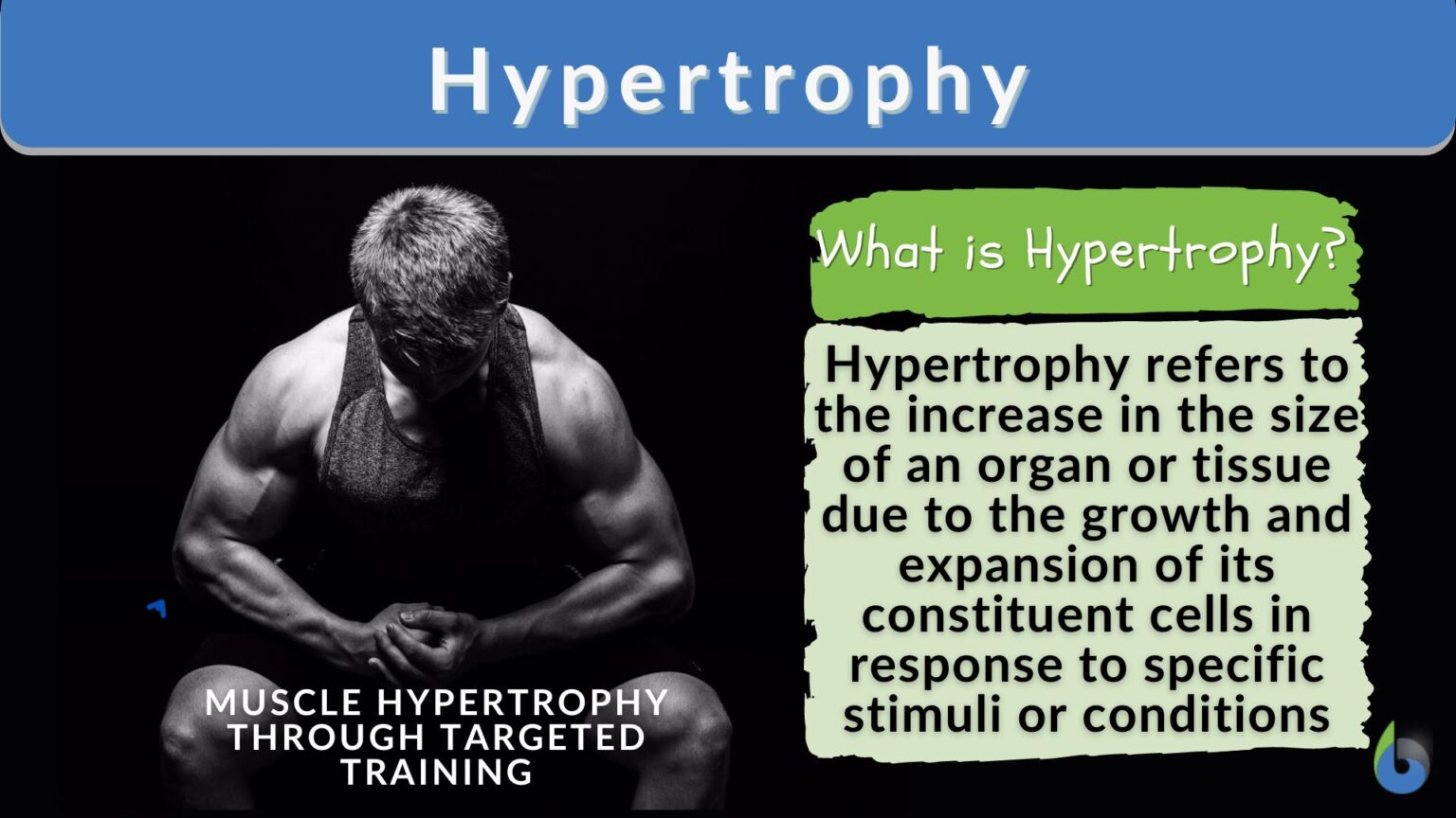 Hypertrophy - Definition and Examples - Biology Online Dictionary Hypertrophy - Definition and Examples - Biology Online Dictionary
