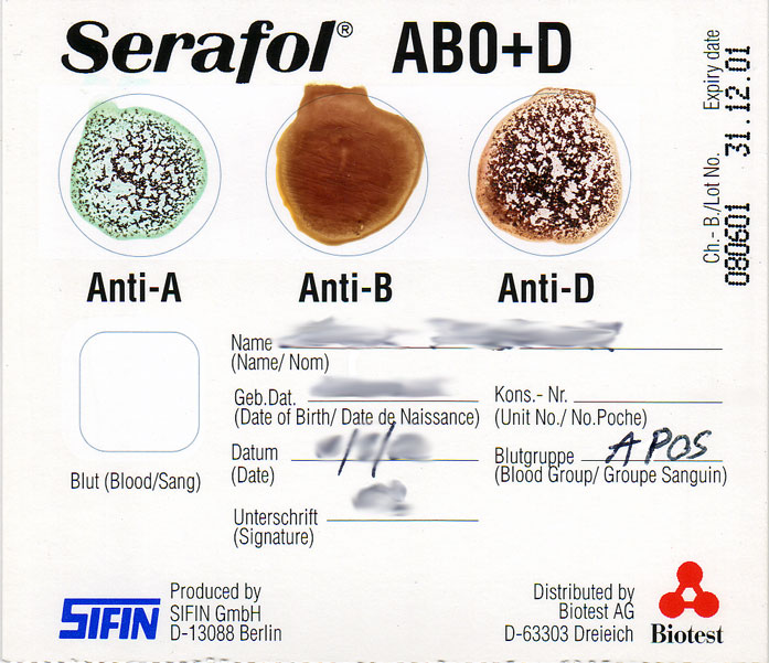 Agglutination - Definition and Examples - Biology Online Dictionary