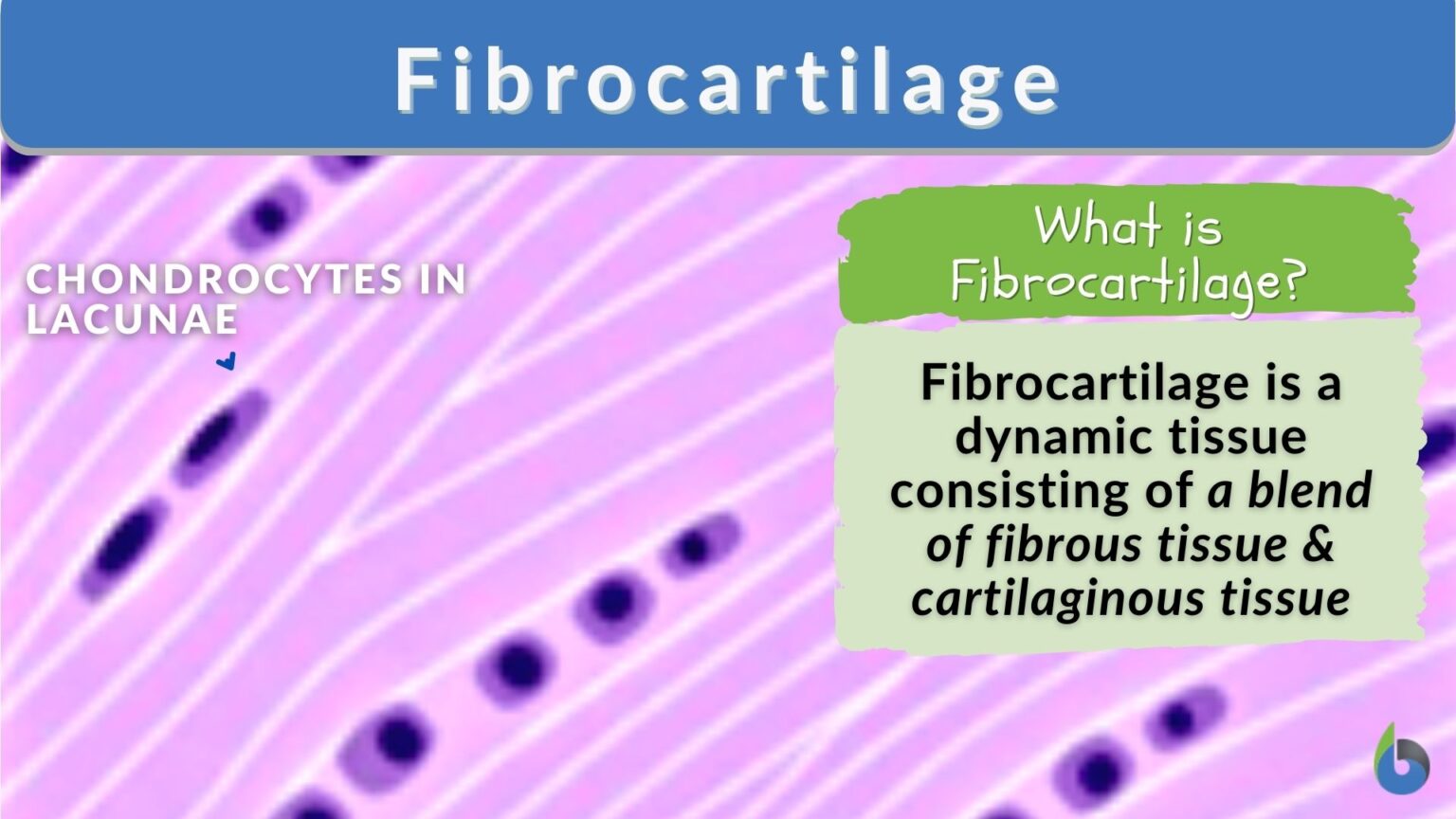 Fibrocartilage - Definition and Examples - Biology Online Dictionary