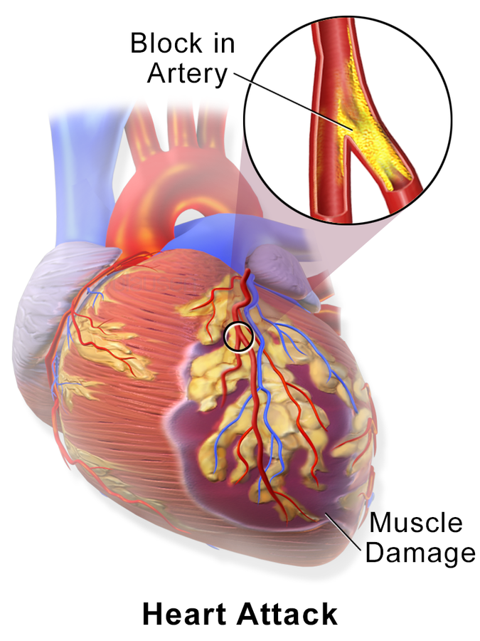 Myocardium Definition and Examples - Biology Online Dictionary