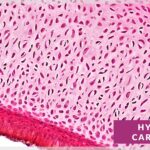 Hyaline cartilage - Definition and Examples - Biology Online Dictionary