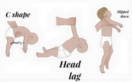 Hypotonic - Definition and Examples - Biology Online Dictionary