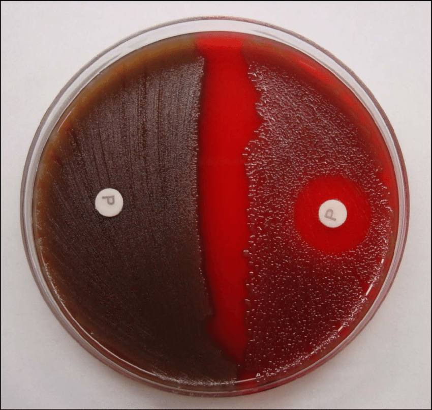 Susceptible - Definition and Examples - Biology Online Dictionary