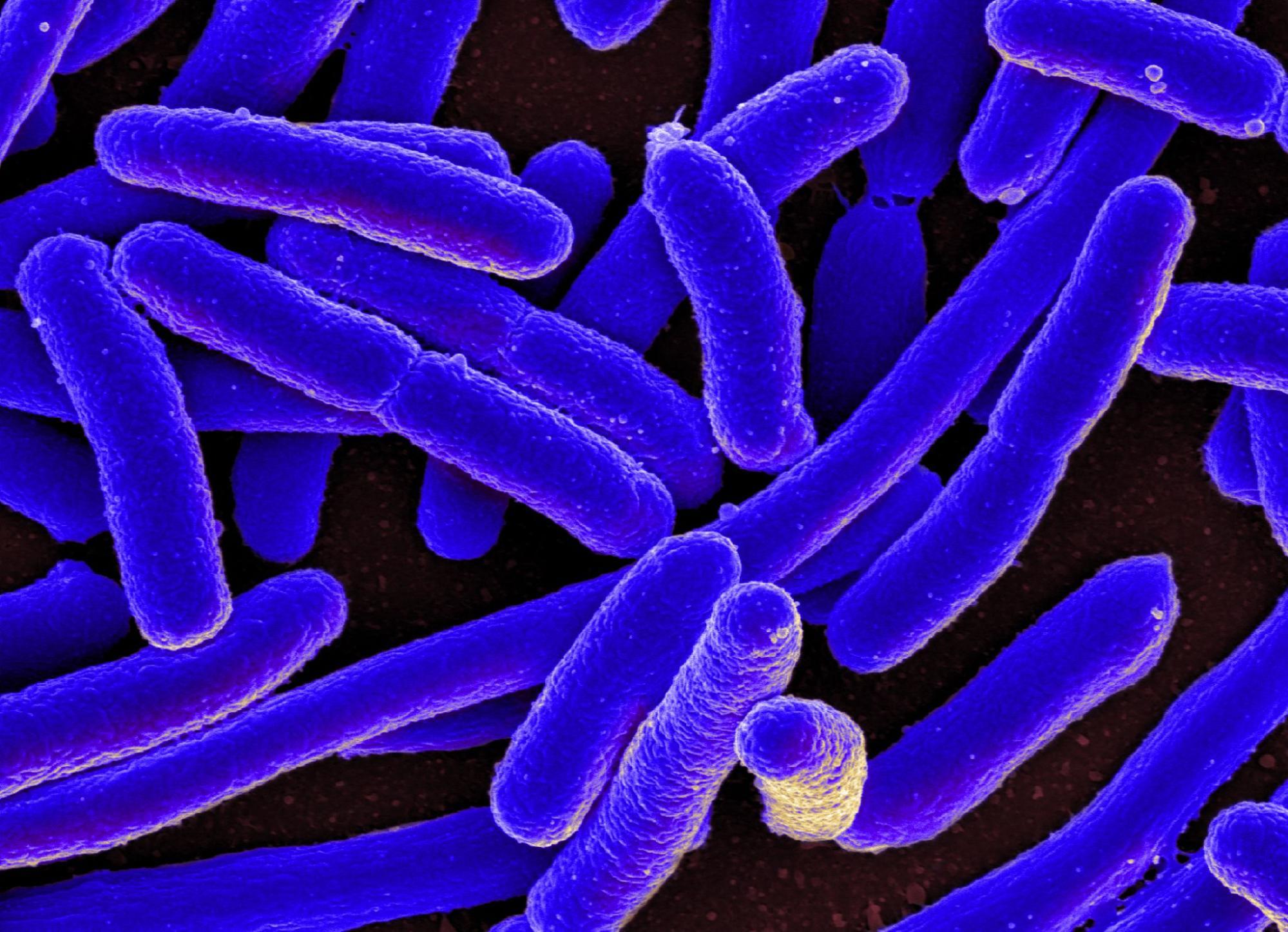 Microbe - Definition and Examples - Biology Online Dictionary