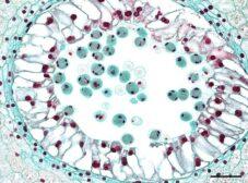 Anther Definition and Examples - Biology Online Dictionary