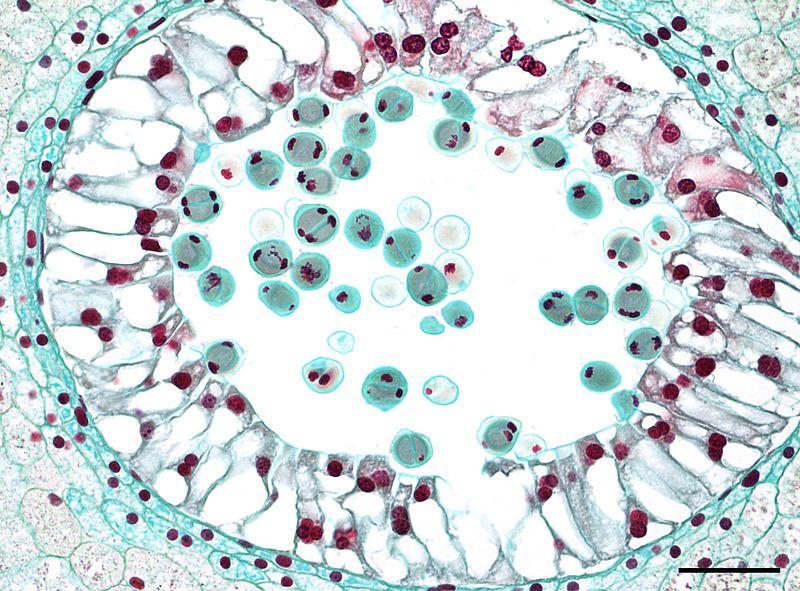 Anther Definition and Examples - Biology Online Dictionary