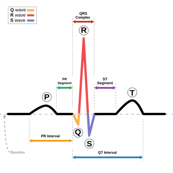 Agonal rhythm - Definition and Examples - Biology Online Dictionary