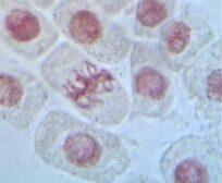 Metaphase Definition and Examples - Biology Online Dictionary