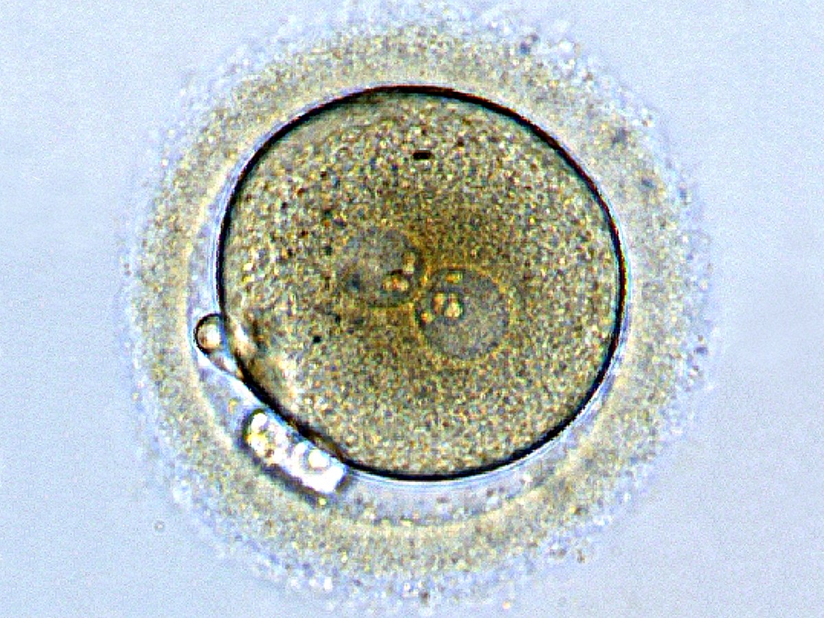 Zygote Definition and Examples - Biology Online Dictionary