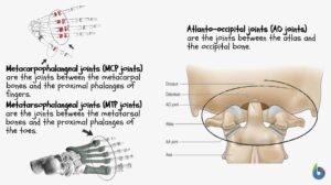 Condyloid joint - Definition and Examples - Biology Online Dictionary