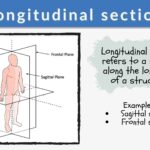 Longitudinal section - Definition and Examples - Biology Online Dictionary